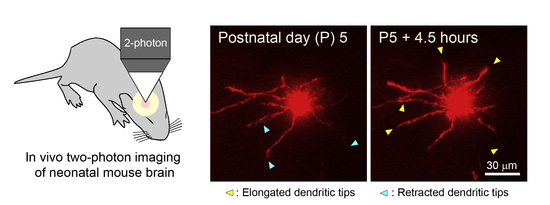 【Publications】In Vivo Two-photon Imaging of Cortical Neurons in ...
